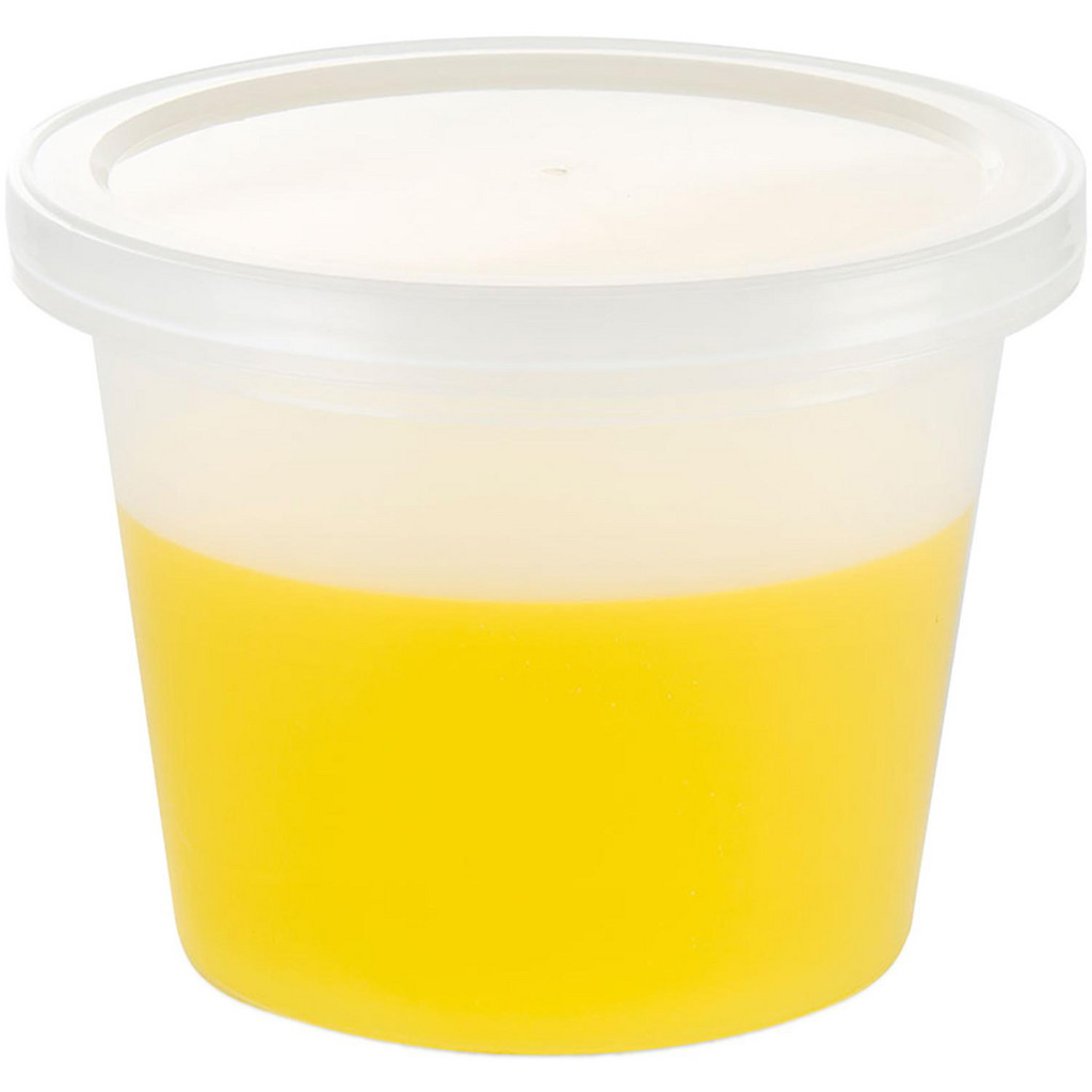 Globe Scientific - Specimen & Sample Containers: Type: Multi-Purpose ...