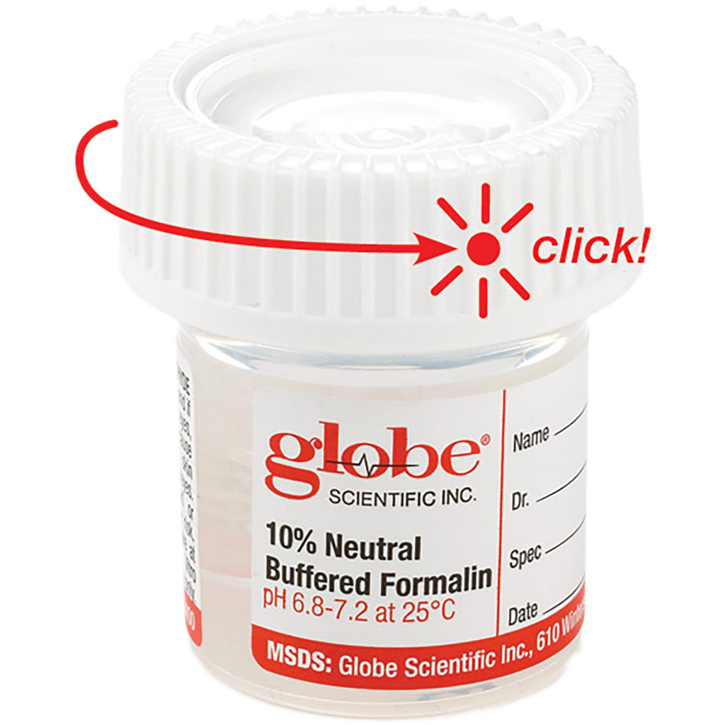 Globe Scientific - Pre-Filled Specimen Containers: Contents: Formalin ...