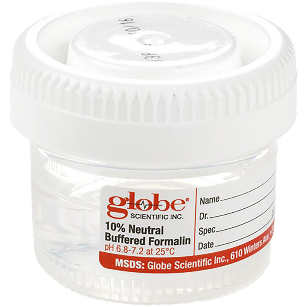 Globe Scientific - Pre-Filled Specimen Containers: Contents: Formalin ...