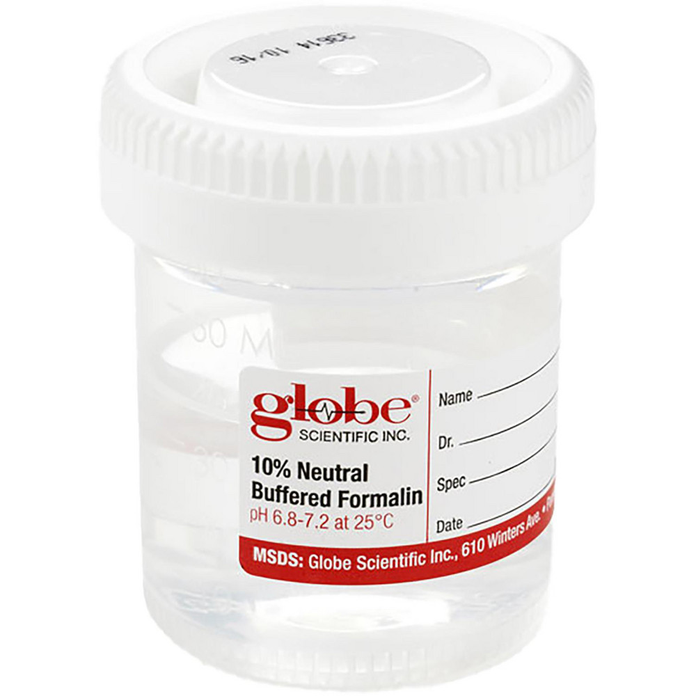 Globe Scientific - Pre-Filled Specimen Containers: Contents: Formalin ...
