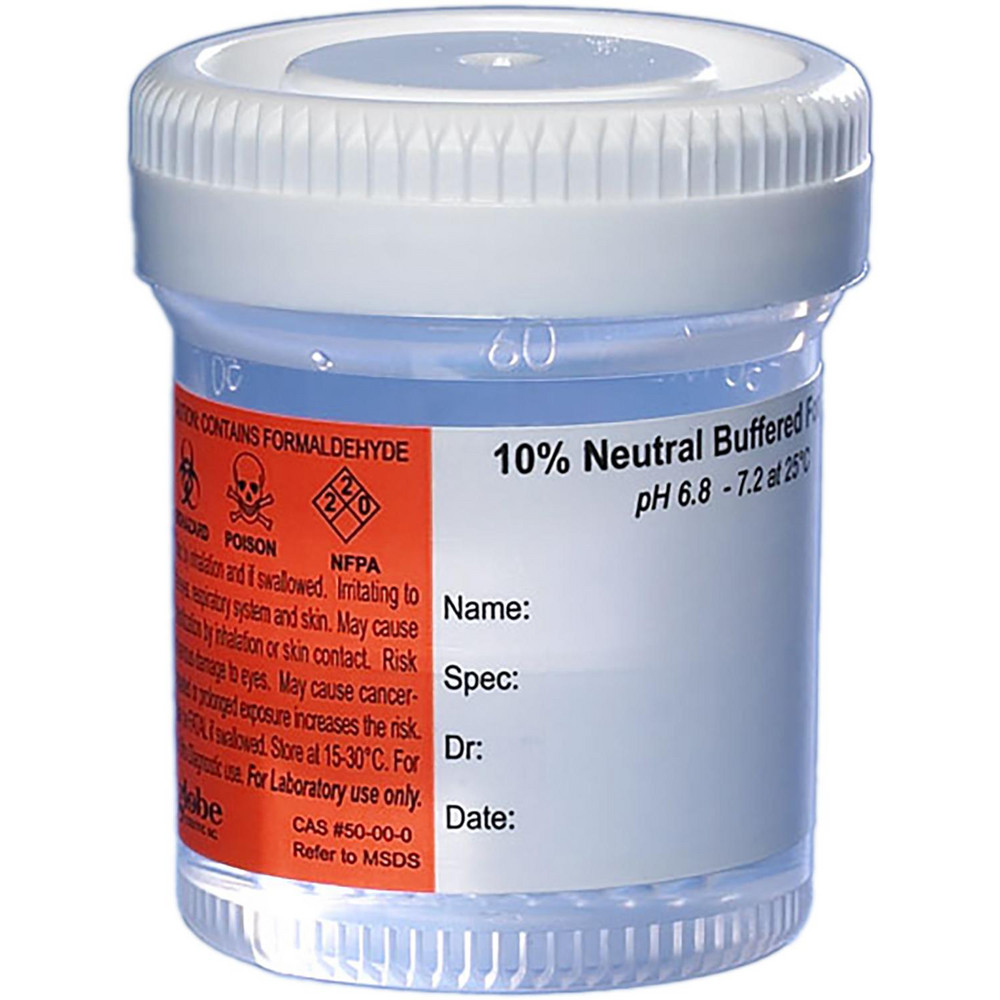 Globe Scientific - Pre-Filled Specimen Containers: Contents: Formalin ...