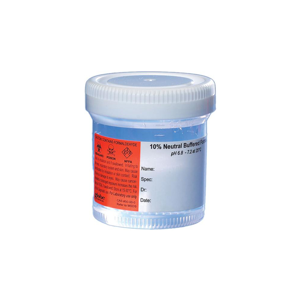 Globe Scientific - Pre-Filled Specimen Containers: Contents: Formalin; Net Fill (ml): 45 ...