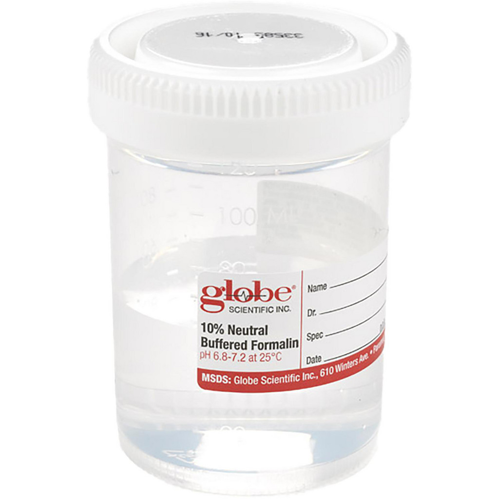 Globe Scientific - Pre-Filled Specimen Containers: Contents: Formalin ...