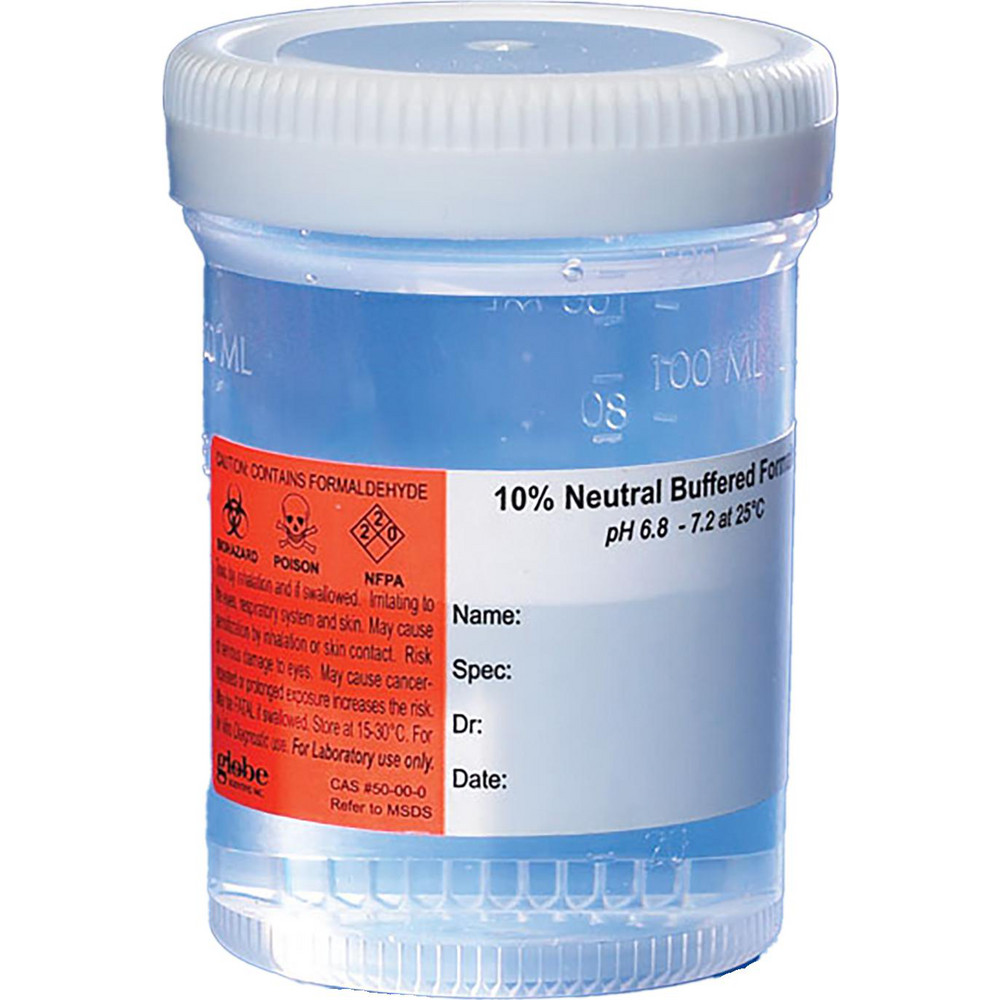 Globe Scientific - Pre-Filled Specimen Containers: Contents: Formalin ...