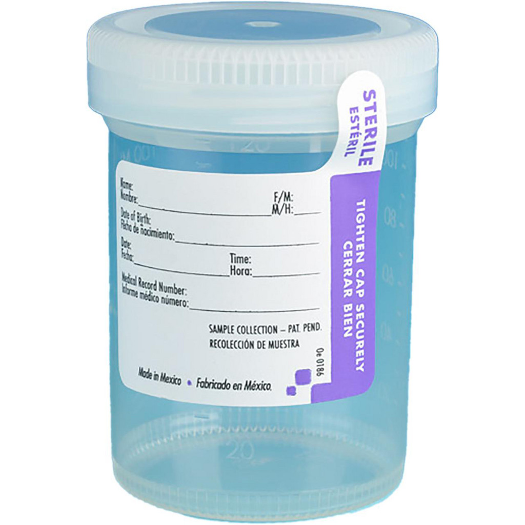 Globe Scientific - Specimen & Sample Containers: Type: Specimen ...