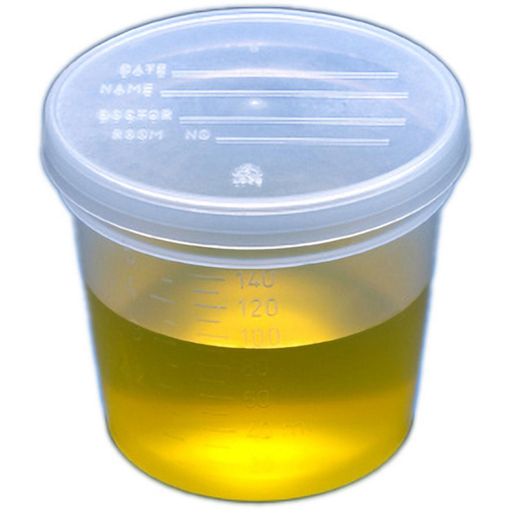 Globe Scientific - Specimen & Sample Containers: Type: Specimen ...