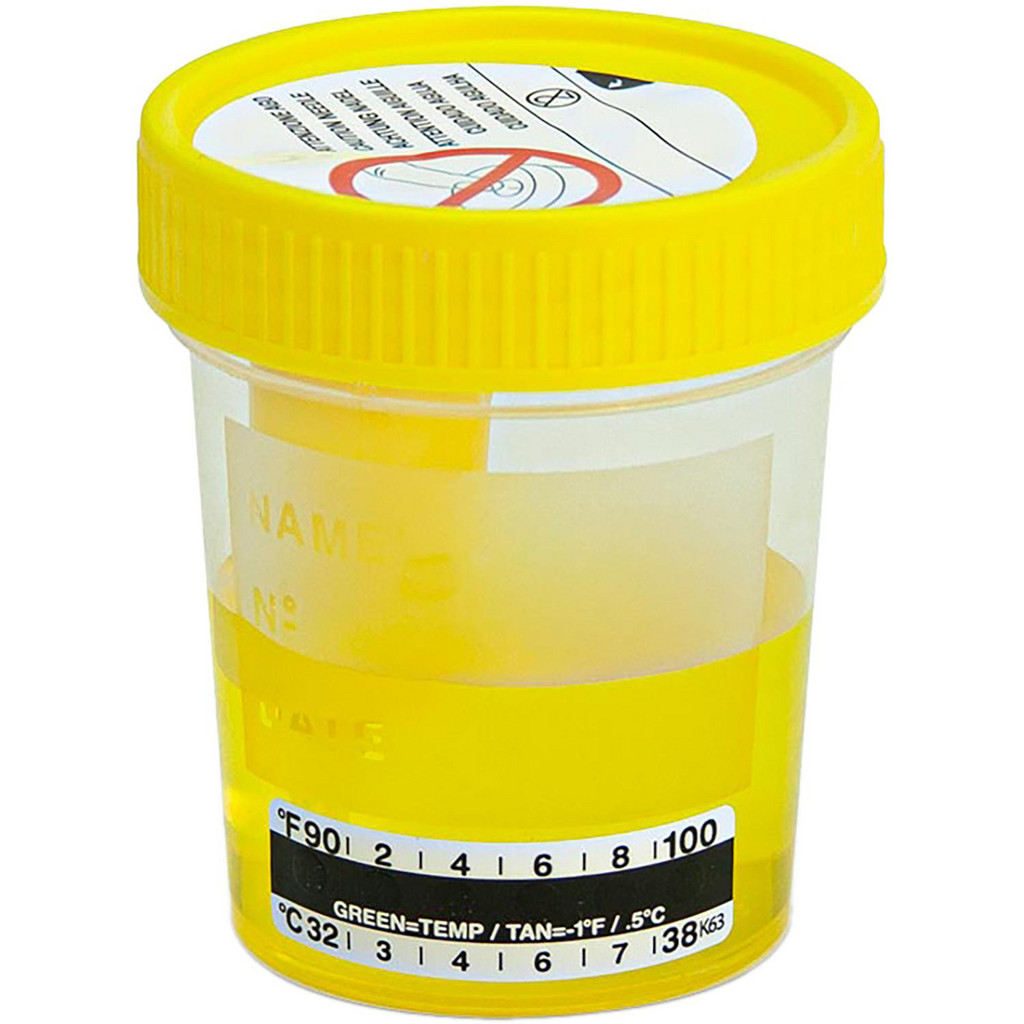 Globe Scientific - Test & Sample Tubes: Type: Urine Centrifuge Tube ...